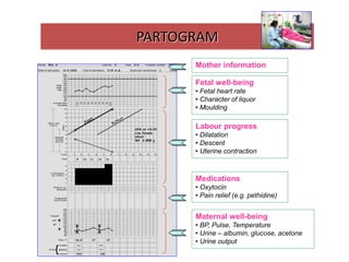 Partogram-kck.ppt