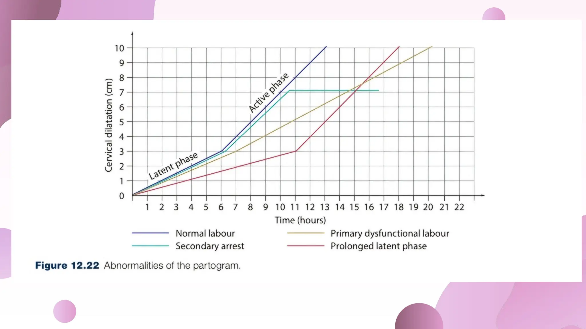 Partogram Partogram Partogram Partogram | PPTX