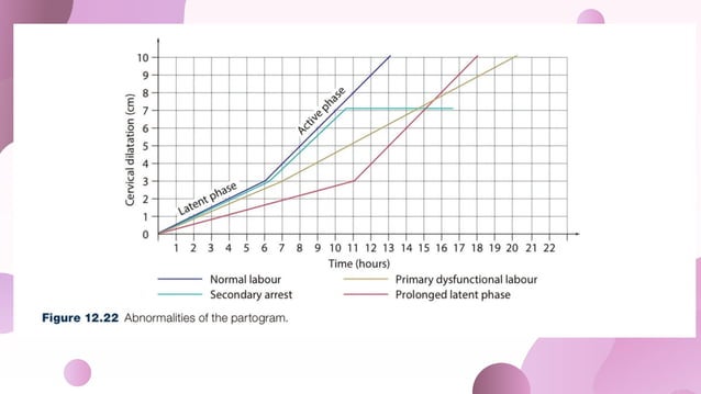 Partogram Partogram Partogram Partogram | PPTX | Pregnancy ...
