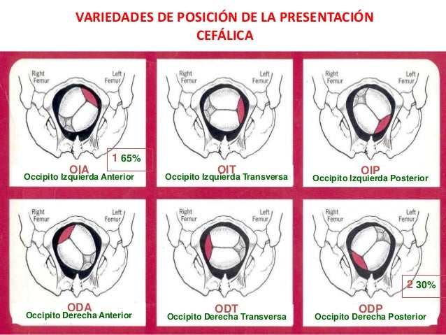 Partograma 2017