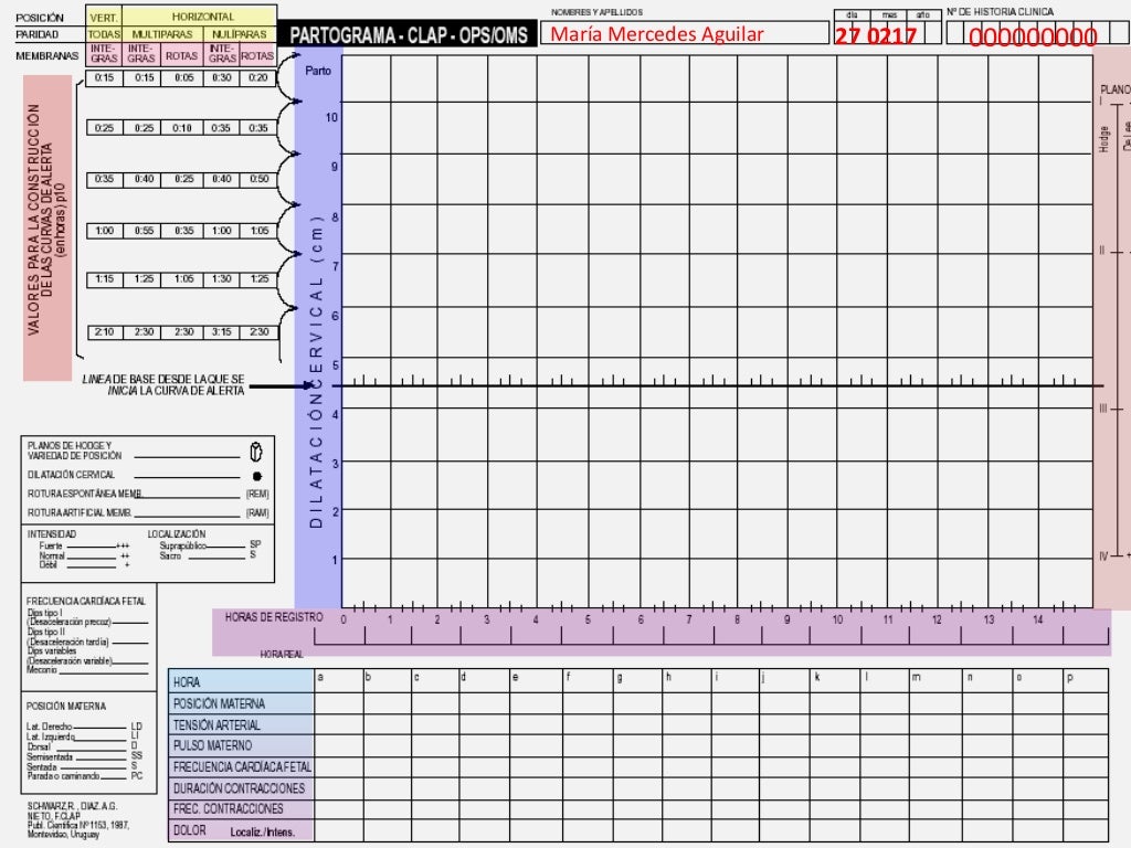 Partograma