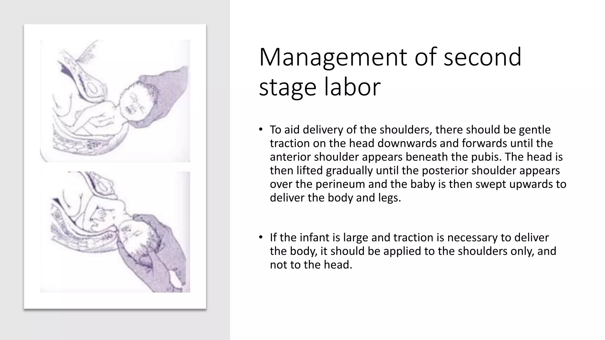 Partogram and management of 1st and 2nd stages of labor | PPTX