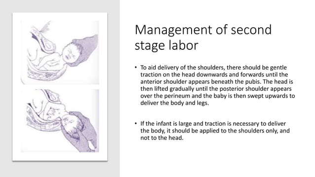 Partogram and management of 1st and 2nd stages of labor | PPT