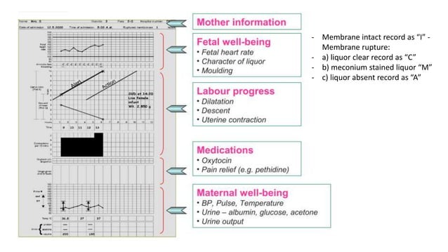 Partogram and management of 1st and 2nd stages of labor