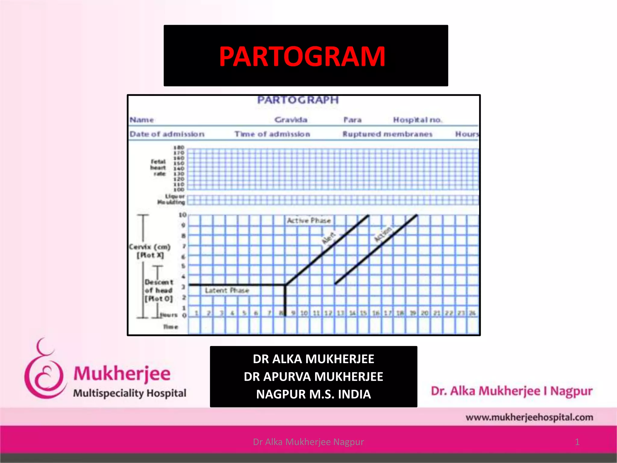Partogram by dr alka mukherjee dr apurva mukherjee nagpur m.s. india ...