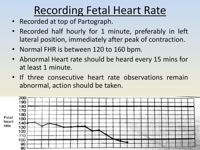 Partogram by Dr Uttara Gupta | PPT