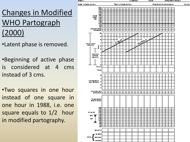 Partogram by Dr Uttara Gupta | PPT