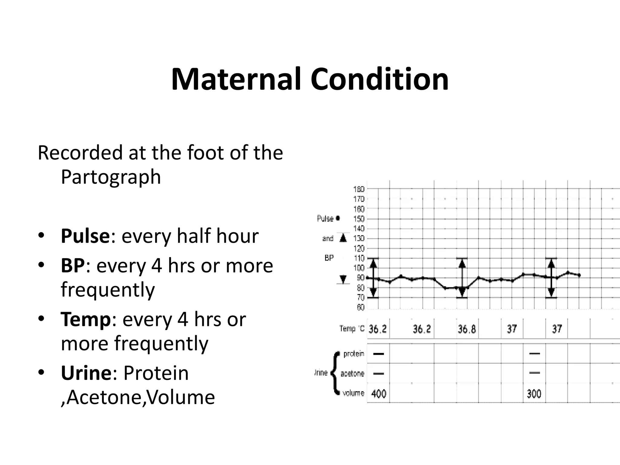Partograph- Made easy for undergraduates | PPTX