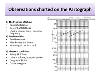Partograph- Made easy for undergraduates | PPTX