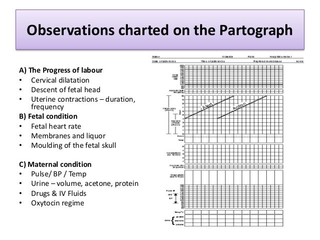 Partograph- Made easy for undergraduates