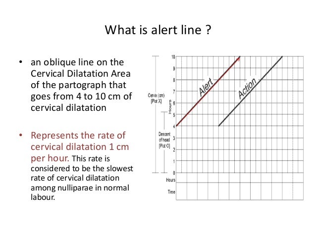 Partograph- Made easy for undergraduates