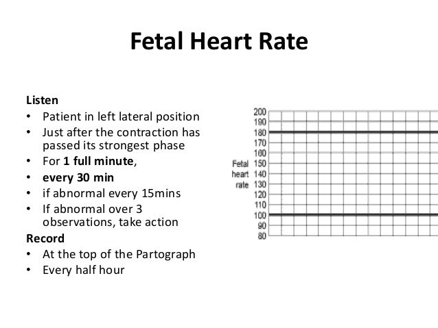 Partograph- Made easy for undergraduates