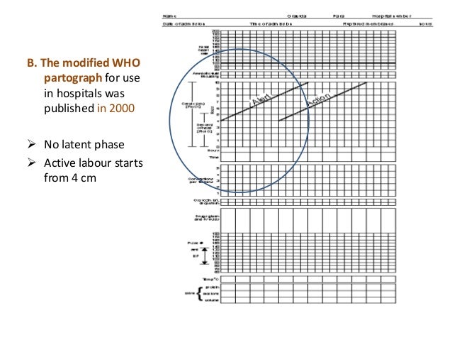Partograph- Made easy for undergraduates
