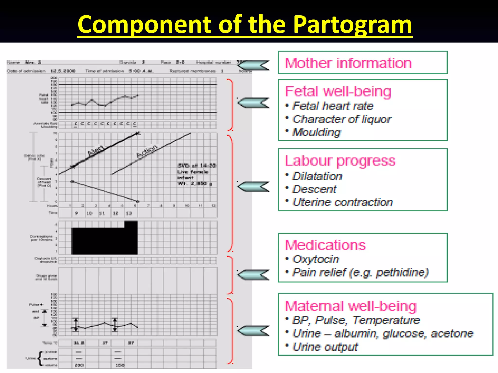 Partograph | PDF