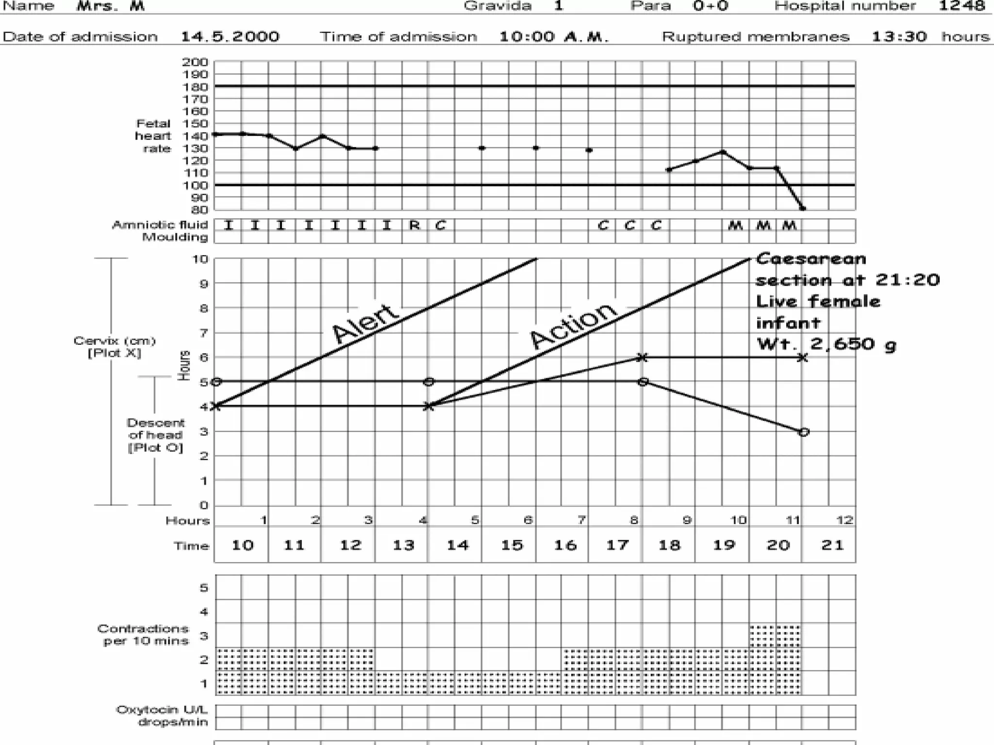 Partograph | PDF | Pregnancy | Reproductive Health