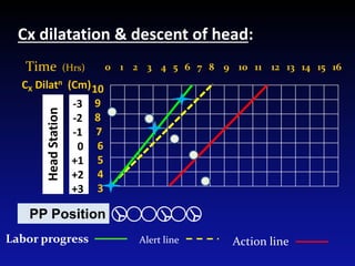 Partograph | PDF