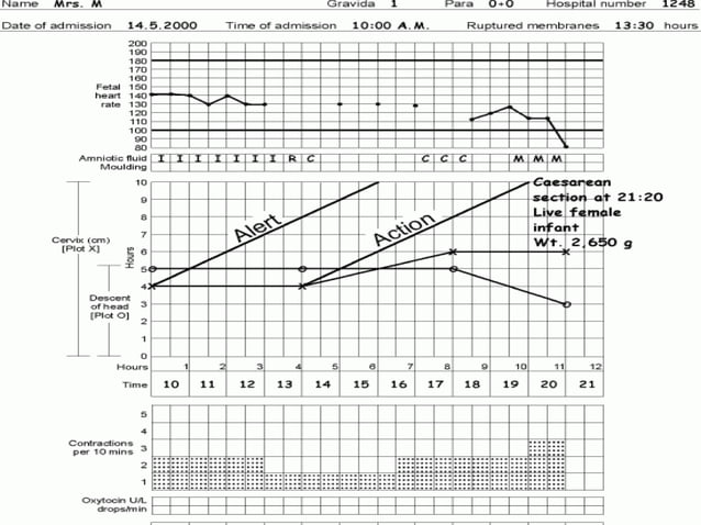 Partograph | PDF | Pregnancy | Reproductive Health