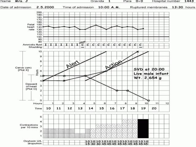 Partograph | PDF | Pregnancy | Reproductive Health