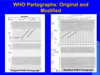 Partograph | PPT