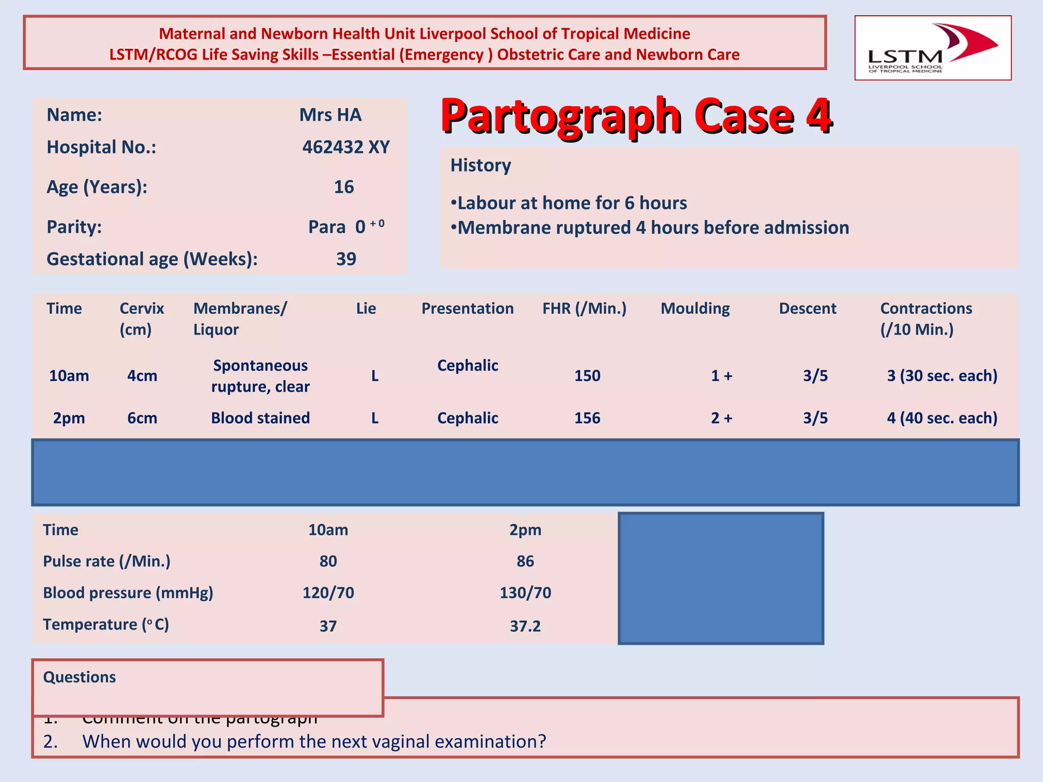 Partograph exercises | PPT
