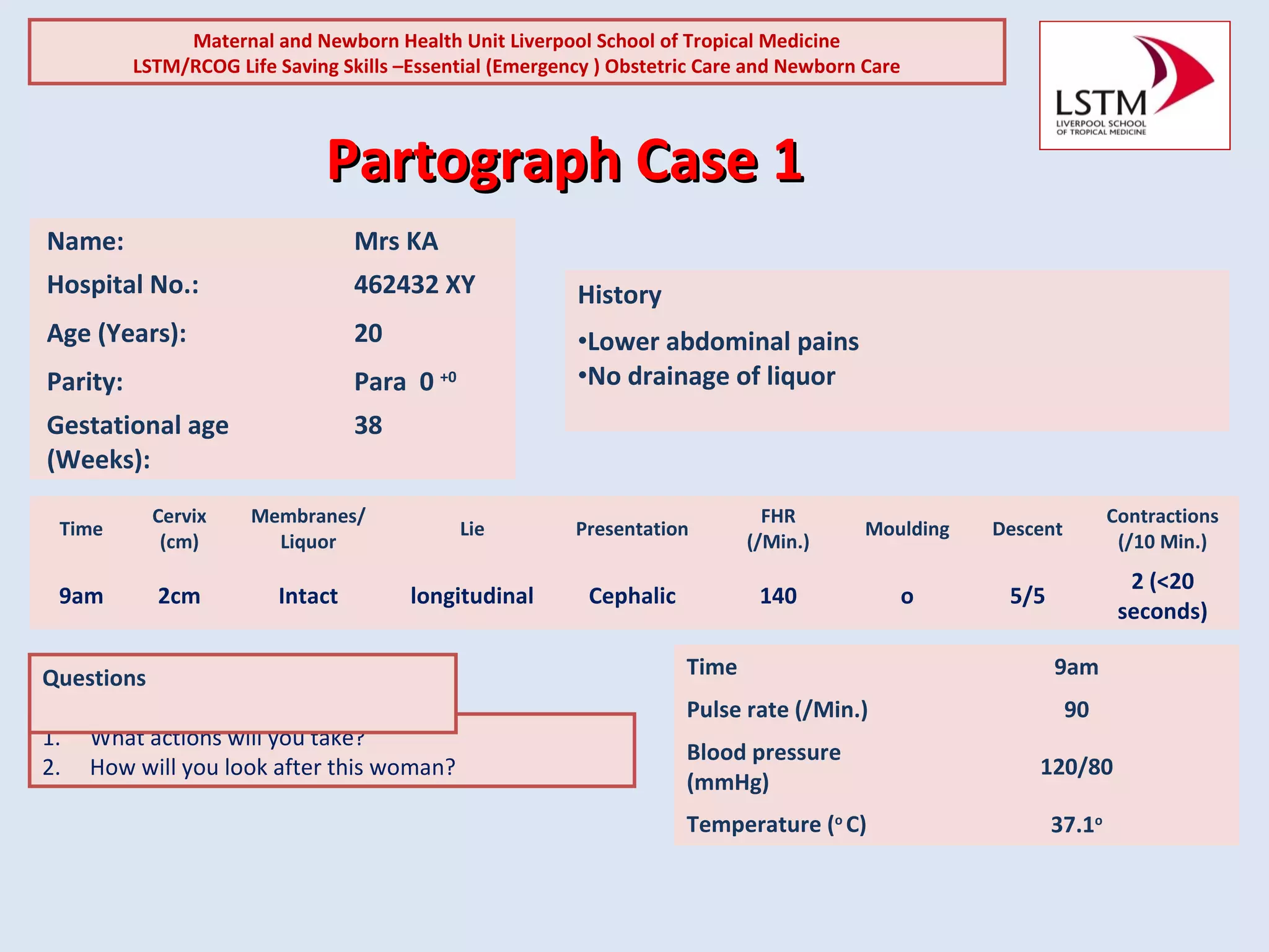 Partograph exercises | PPT