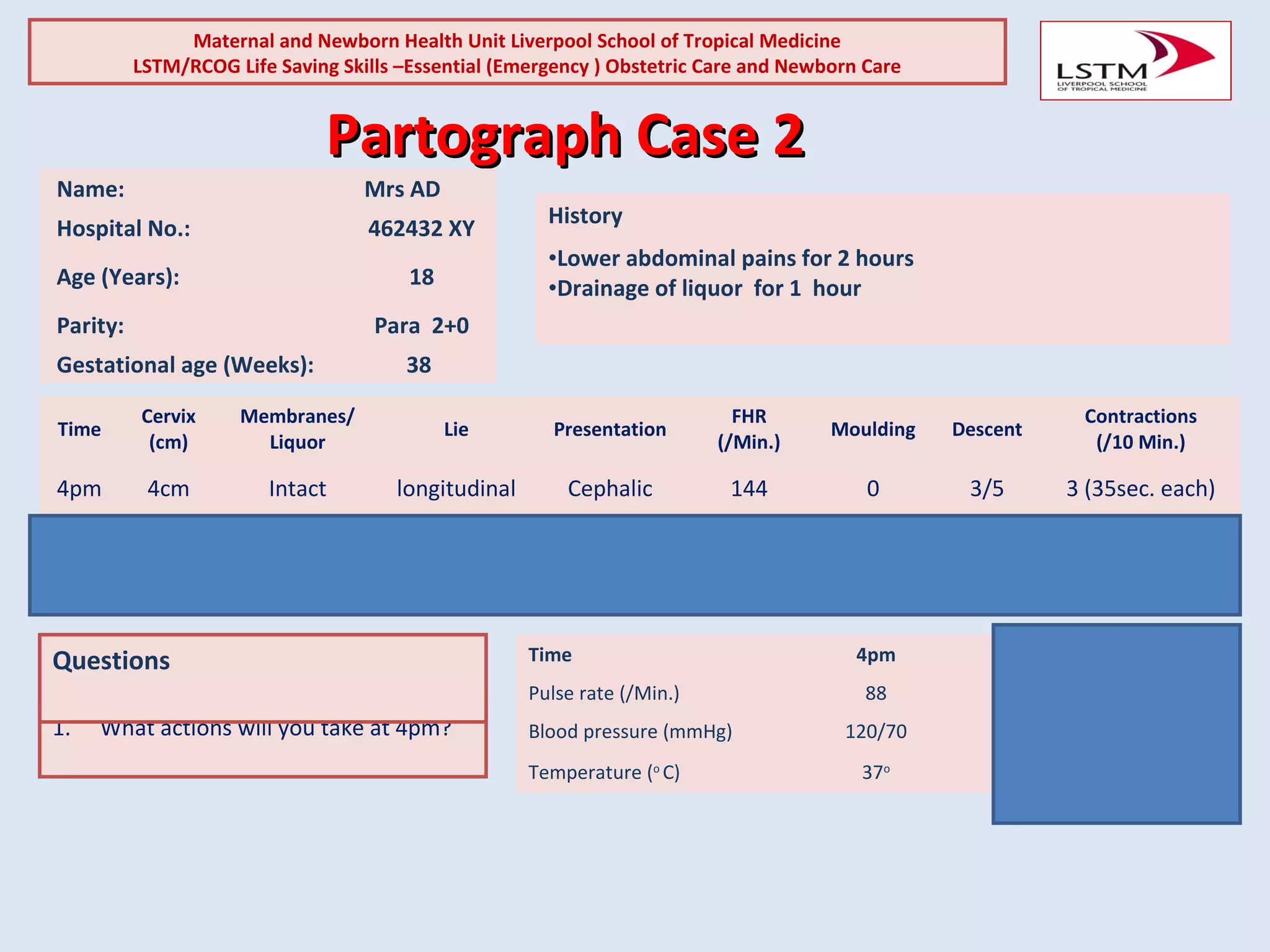 Partograph exercises | PPT