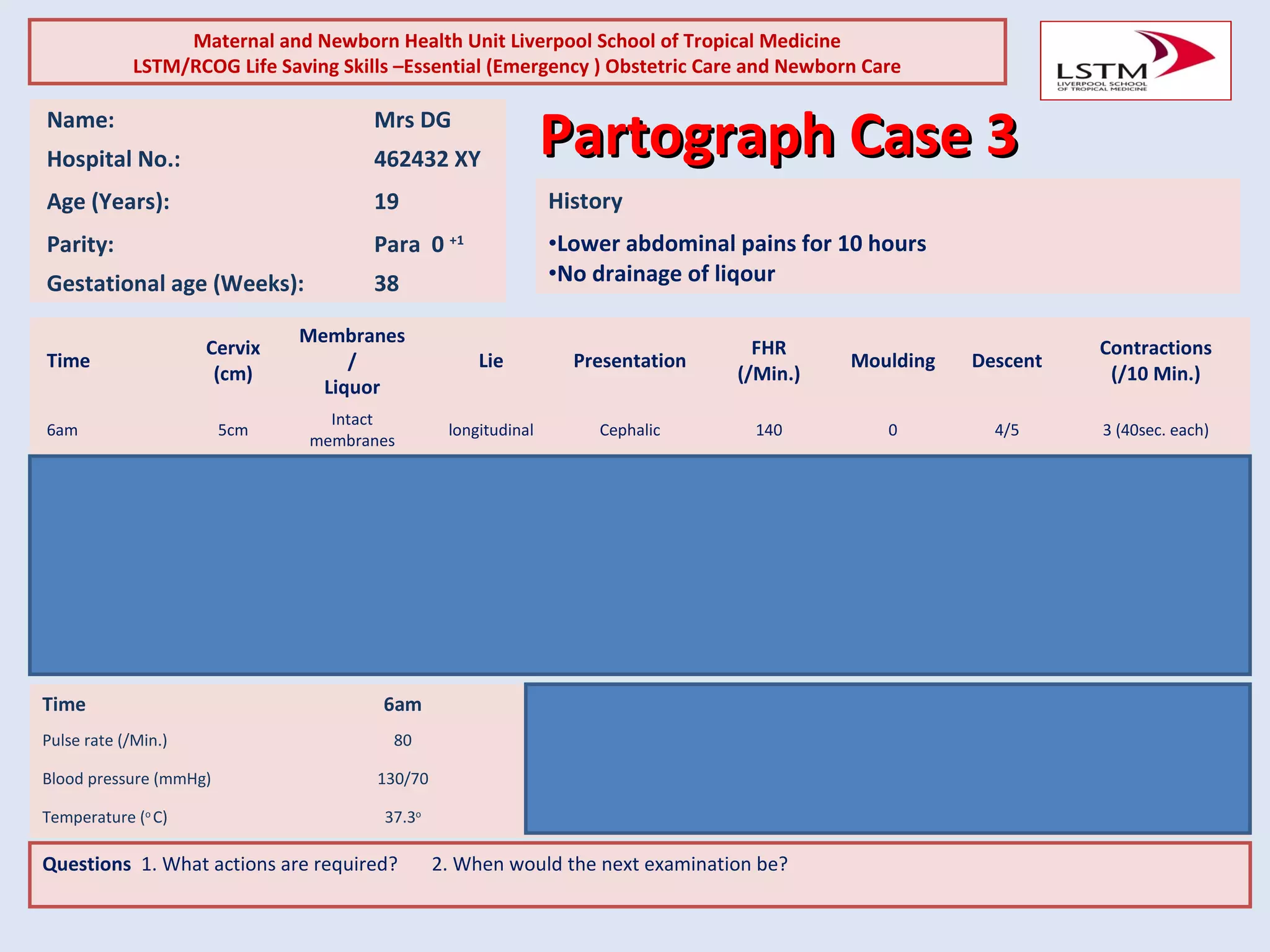 Partograph exercises | PPT