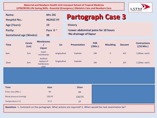 Partograph exercises | PPT