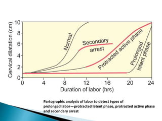Partograph | PPTX
