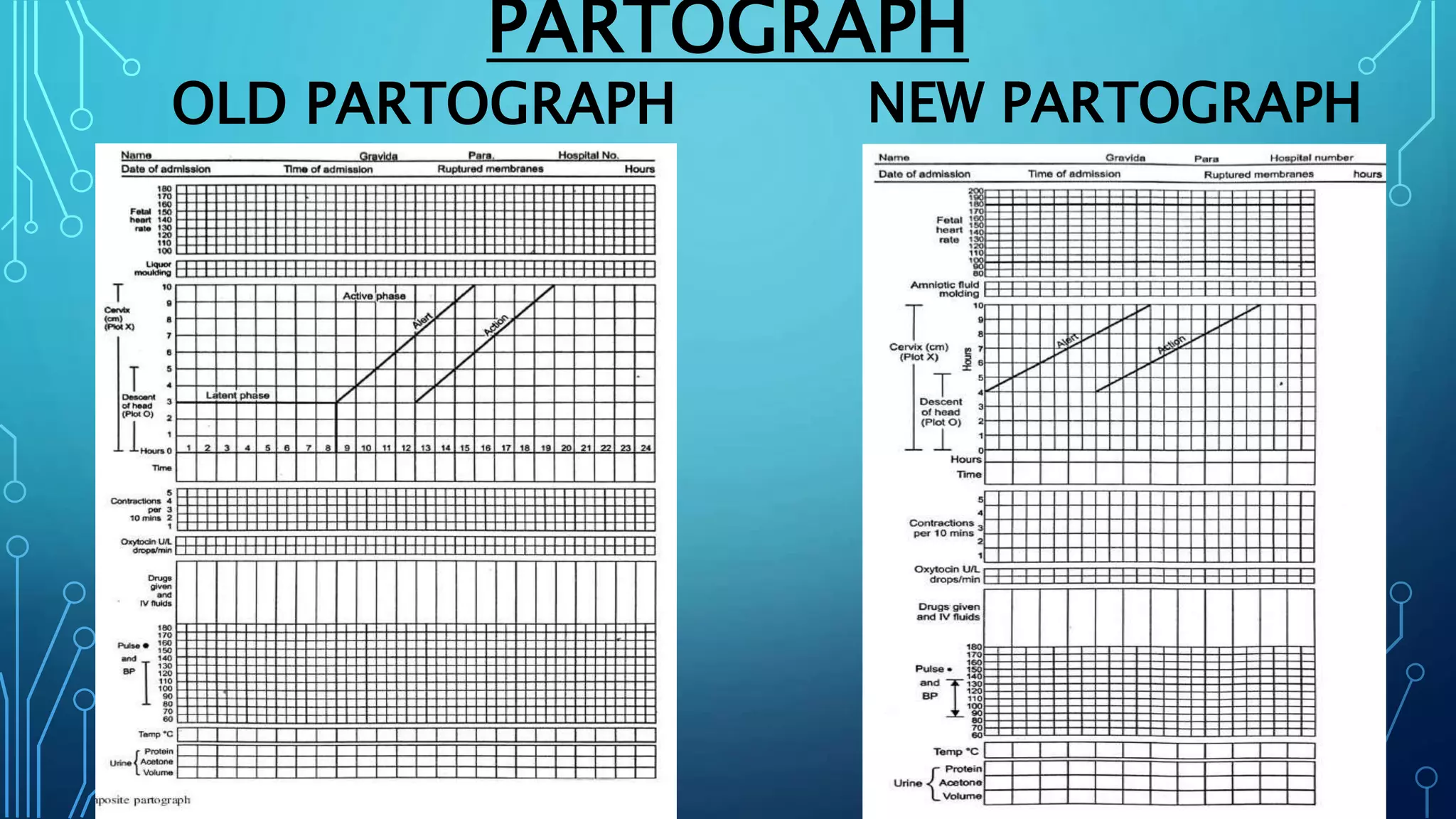Partograph.pptx