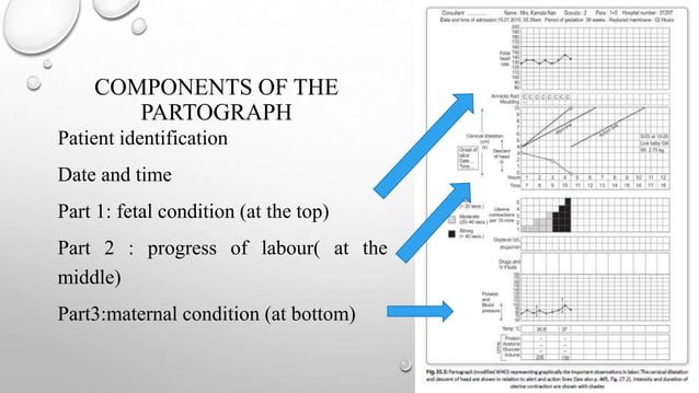 partograph.pptx