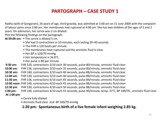 PARTOGRAPH.ppt