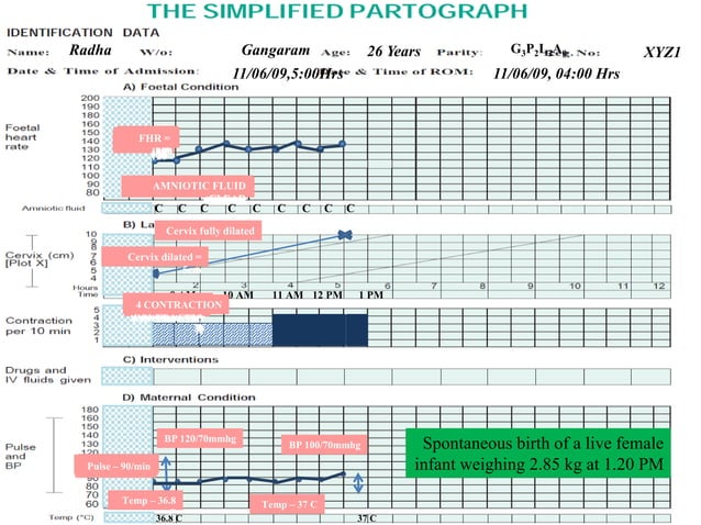 PARTOGRAPH.ppt