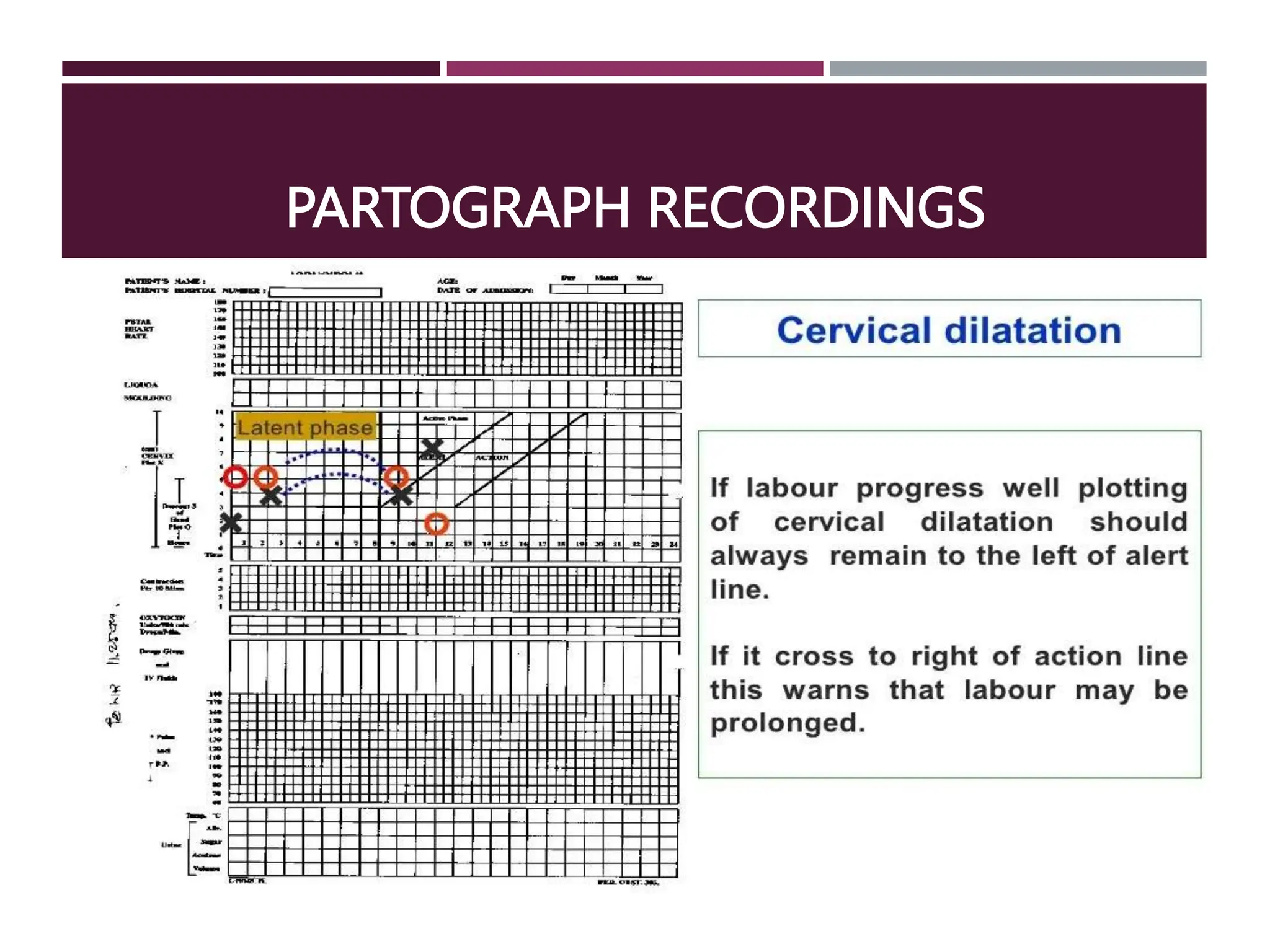 Partograph.pptx Partograph Partograph Partograph | PPTX