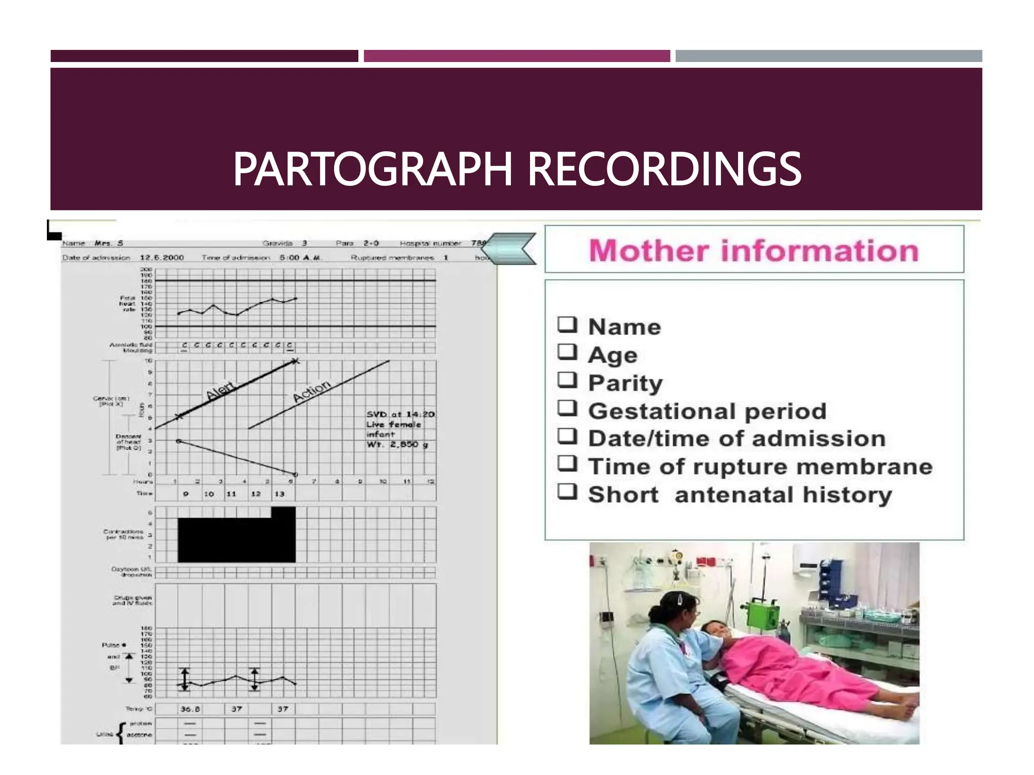 Partograph.pptx Partograph Partograph Partograph | PPTX