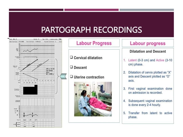 Partograph.pptx Partograph Partograph Partograph | PPTX | Pregnancy | Reproductive Health