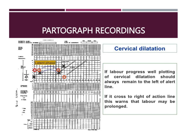 Partograph.pptx Partograph Partograph Partograph | PPTX | Pregnancy ...