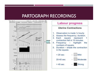 Partograph.pptx Partograph Partograph Partograph | PPTX | Pregnancy ...