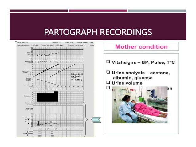 Partograph.pptx Partograph Partograph Partograph | PPTX | Pregnancy ...