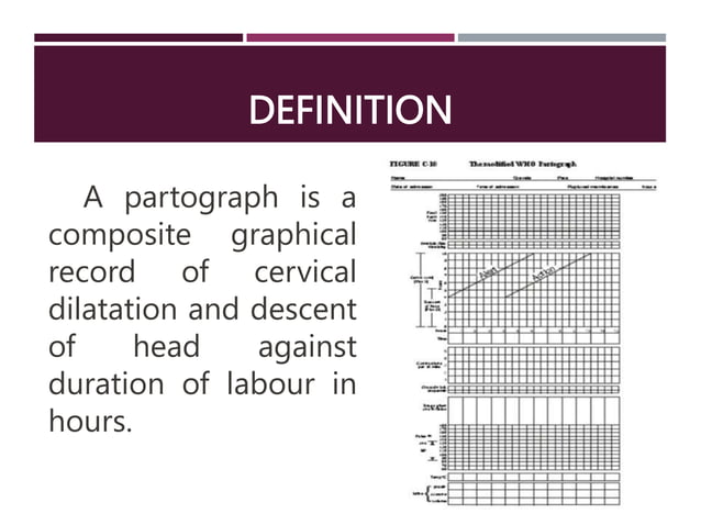 Partograph.pptx Partograph Partograph Partograph | PPTX | Pregnancy | Reproductive Health