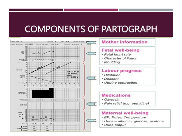 Partograph.pptx Partograph Partograph Partograph | PPTX | Pregnancy ...