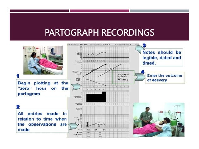 Partograph.pptx Partograph Partograph Partograph | PPTX | Pregnancy ...