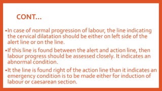 Partograph.pptx....in 1st stage of labour.. | PPT