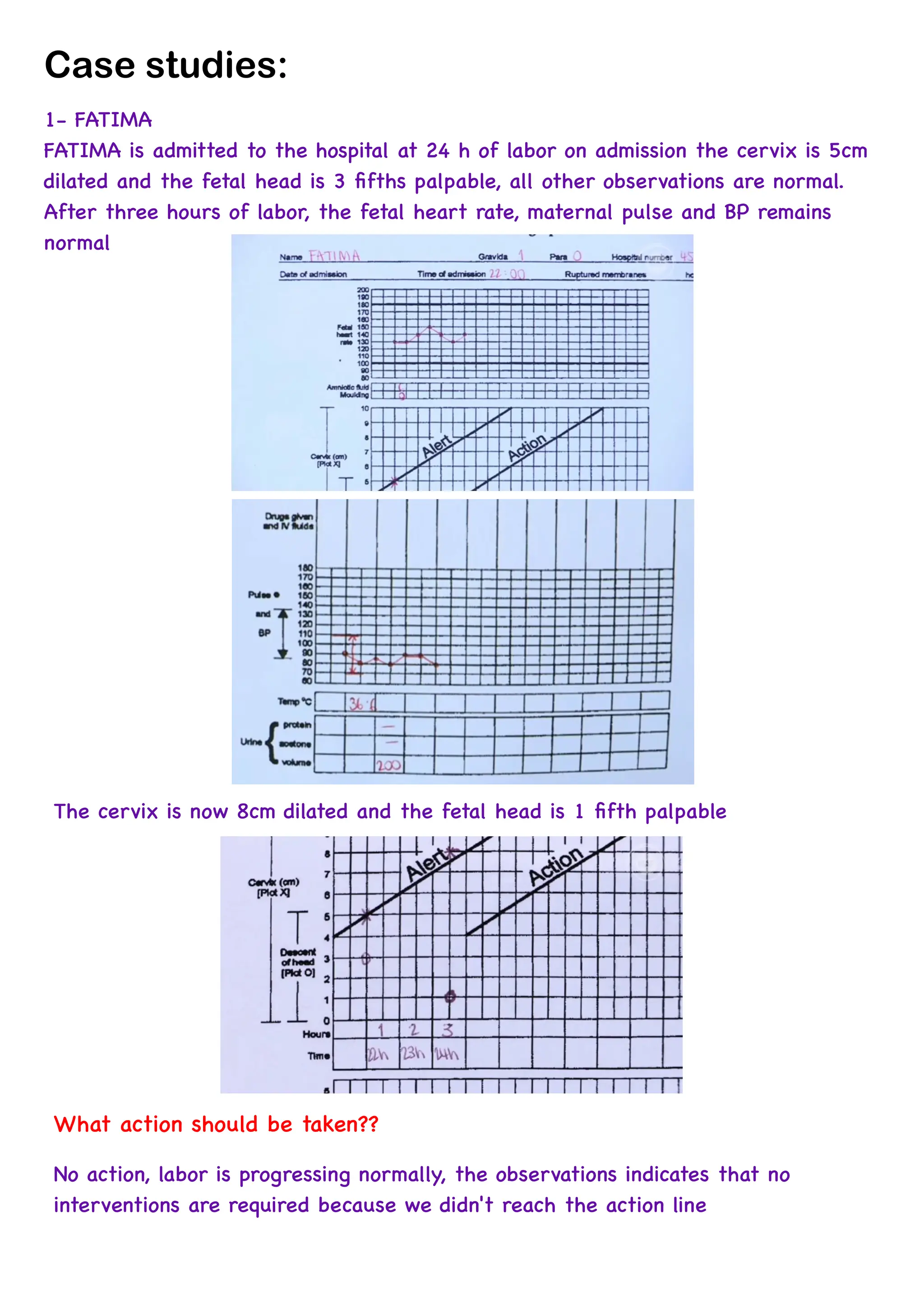partograph gynecology medical lecture for students | PDF