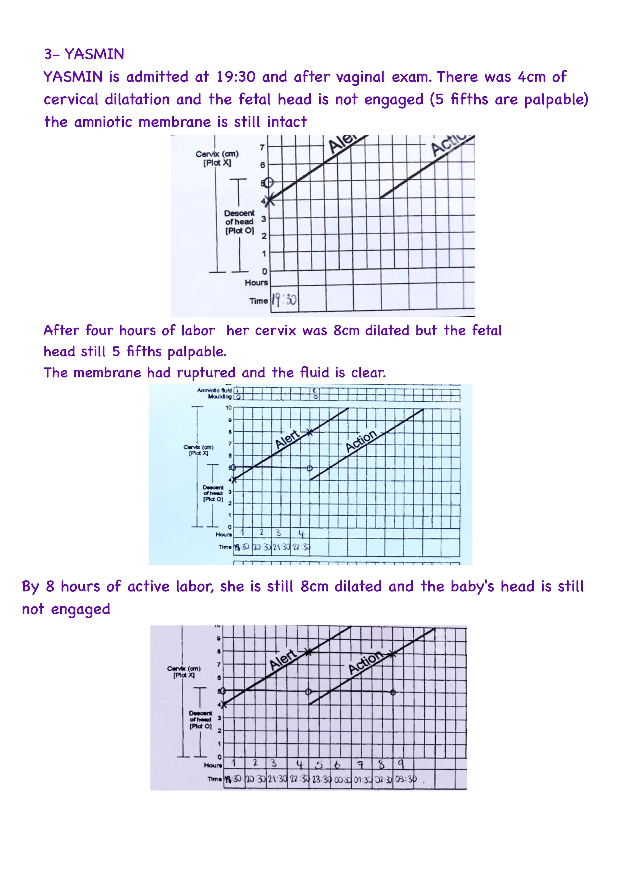 partograph gynecology medical lecture for students | PDF