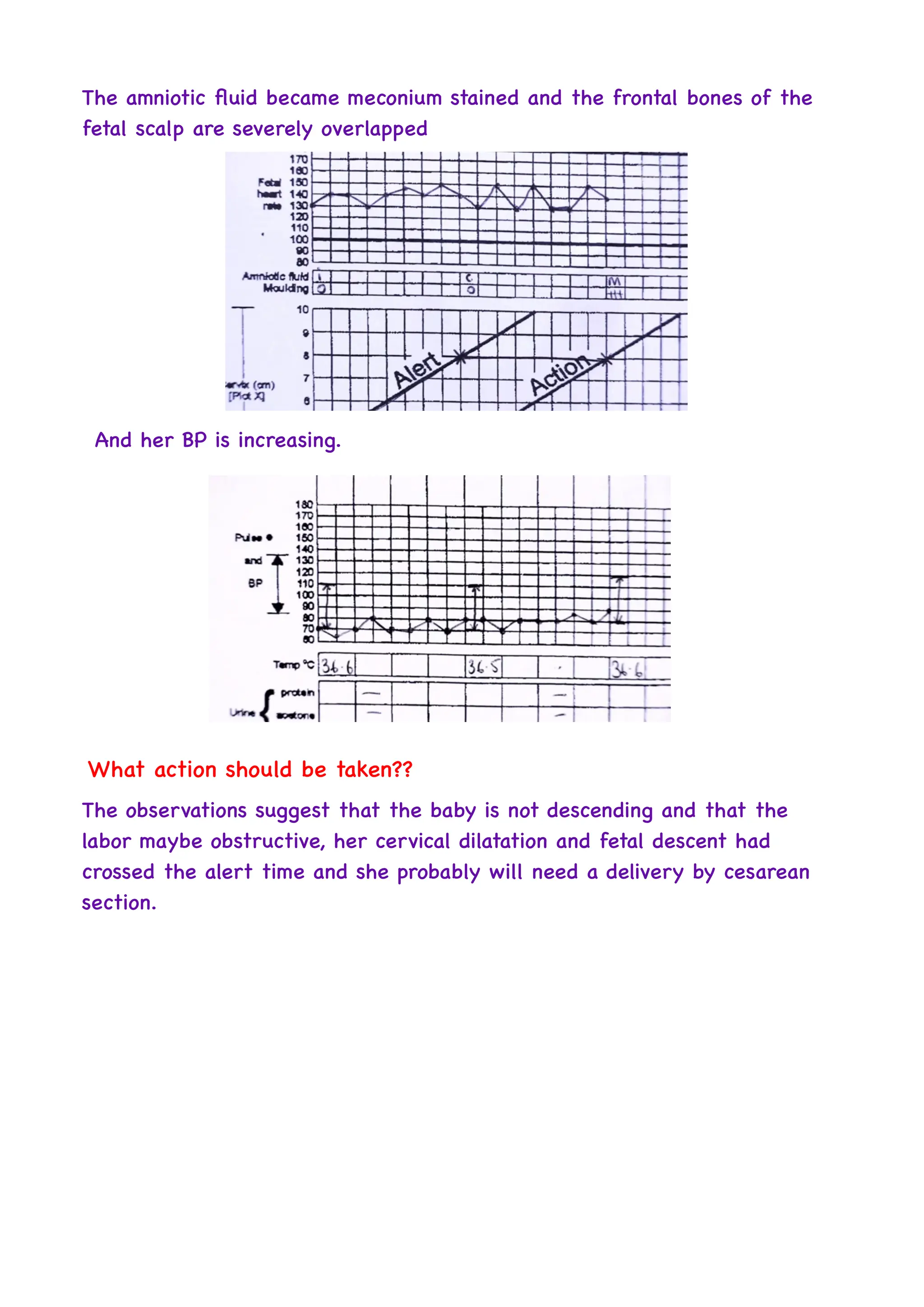 partograph gynecology medical lecture for students | PDF
