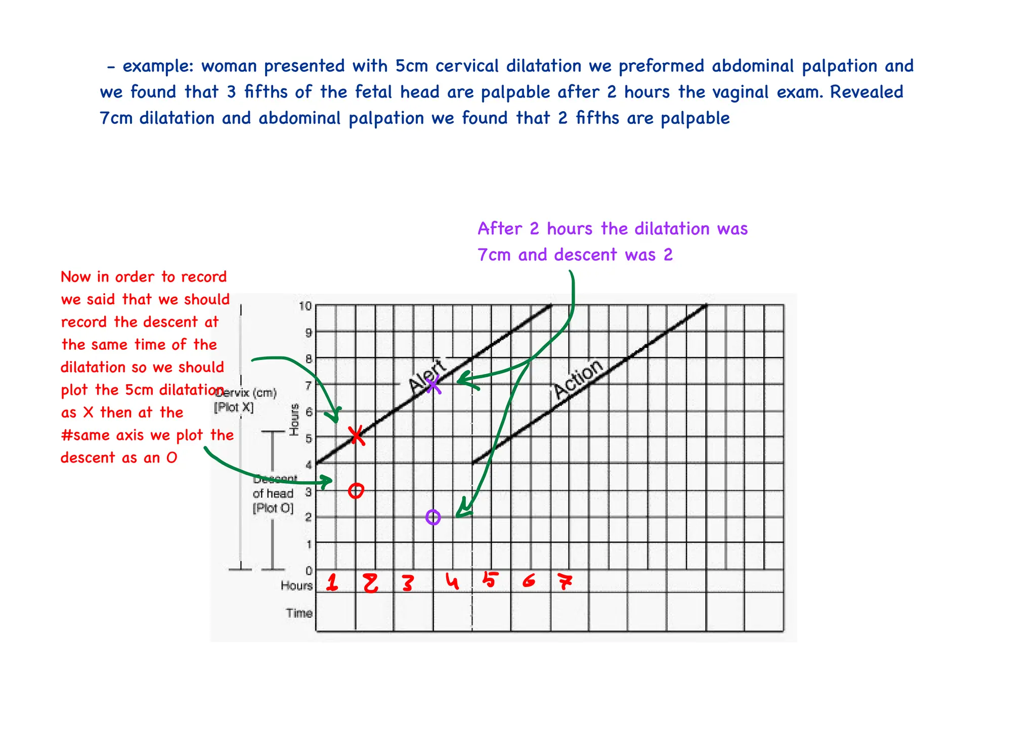 partograph gynecology medical lecture for students | PDF