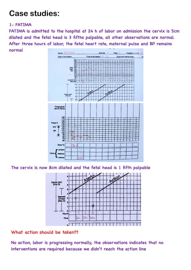 partograph gynecology medical lecture for students | PDF | Pregnancy ...
