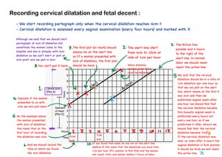 partograph gynecology medical lecture for students | PDF