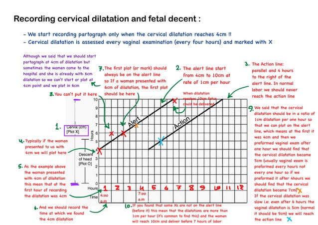 partograph gynecology medical lecture for students | PDF | Pregnancy ...